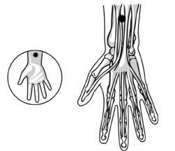 Sleep Solutions from Chinese Masters-Talk East & West--新法家